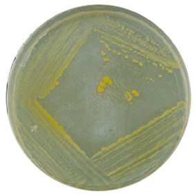 Technology :: Microbes for living...